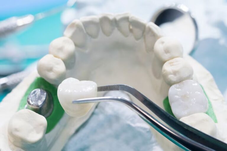 Dental Crowns 101: What to Expect & Care Tips